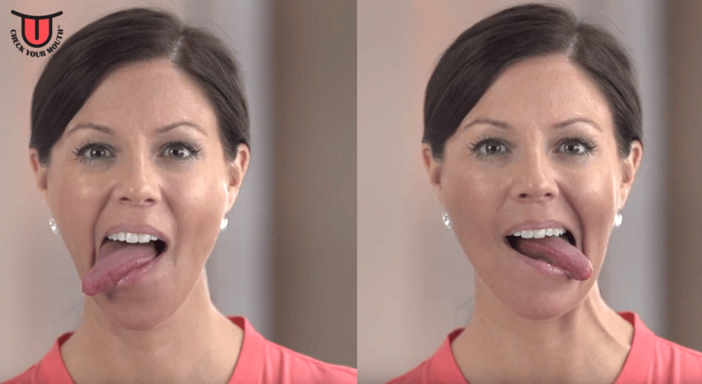 Introduction - Check Your Mouth