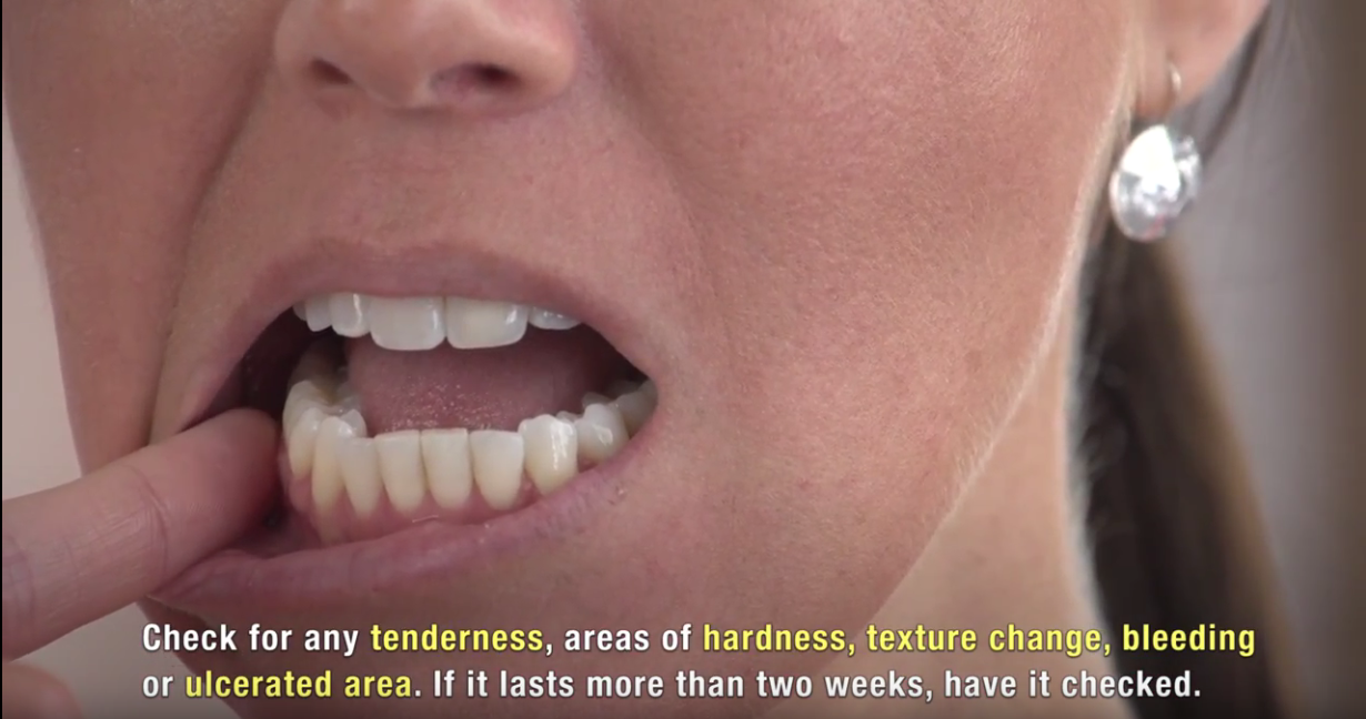 Self-test-10 - Check Your Mouth 2024